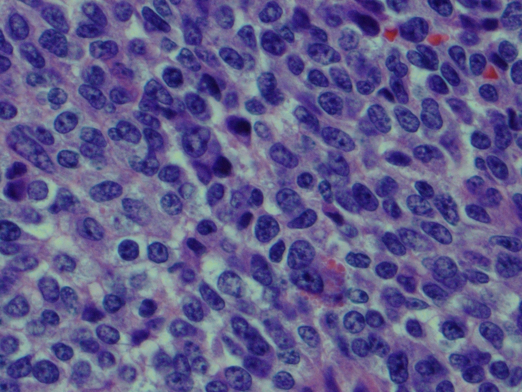 HPA – Hackensack Pathology Associates