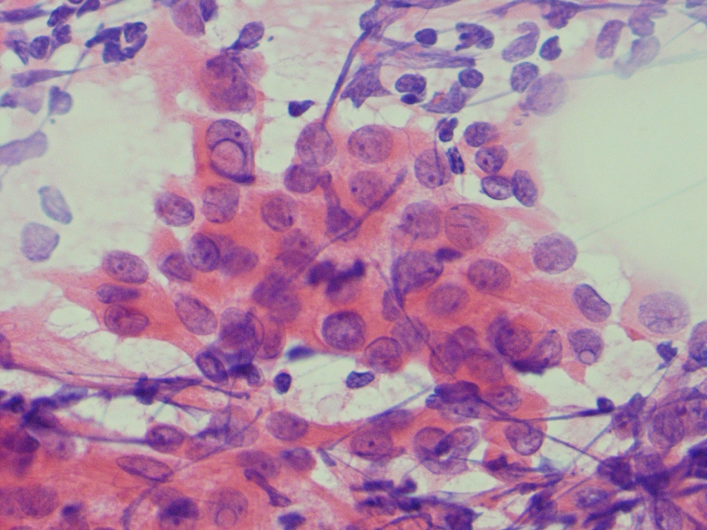 HPA – Hackensack Pathology Associates